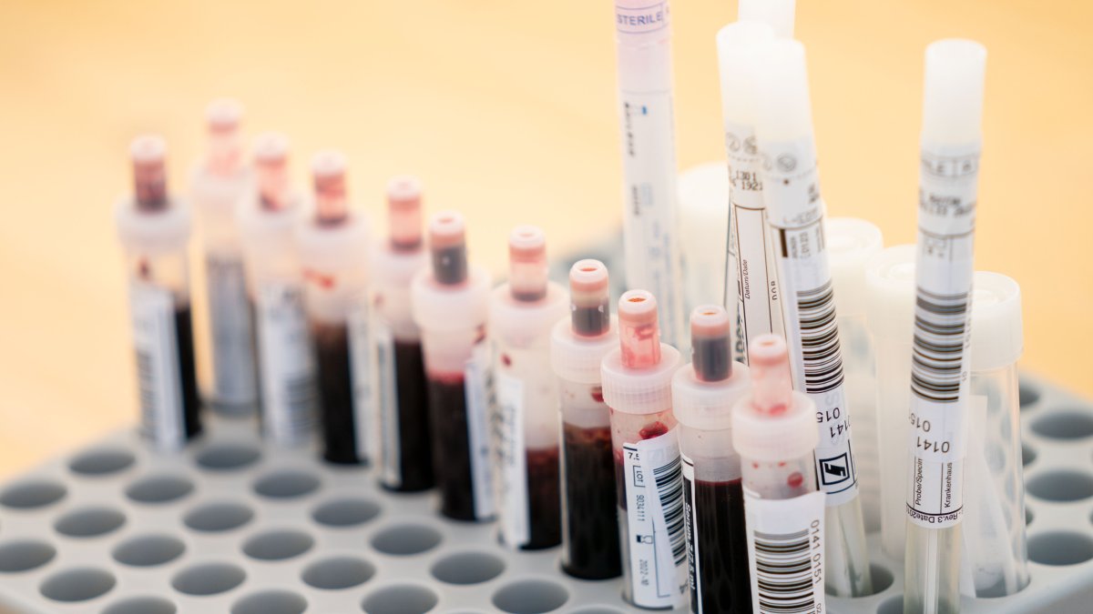 San Francisco’s Mission District Offers Free COVID-19 Testing – NBC Bay ...