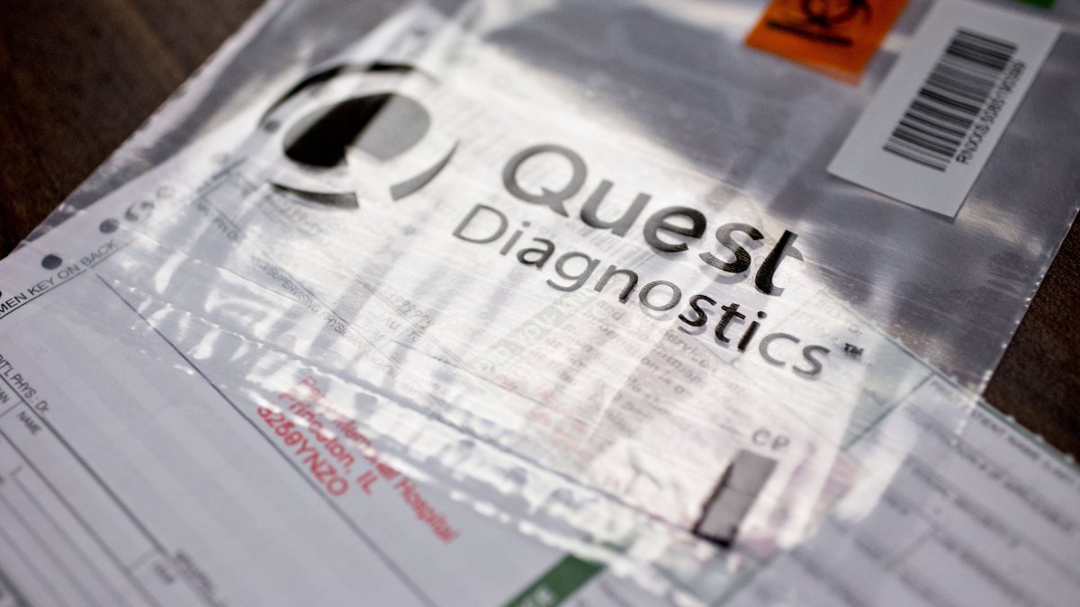 FDA Approves Quest COVID-19 Test for ‘pooled’ Sample Use – NBC Bay Area FDA Approves Quest COVID-19 Test for ‘pooled’ Sample Use – NBC Bay Area