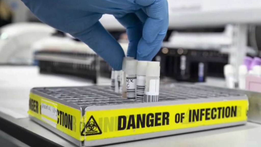 Google Sister Company Rolls Out Coronavirus Screening Form – NBC Bay Area