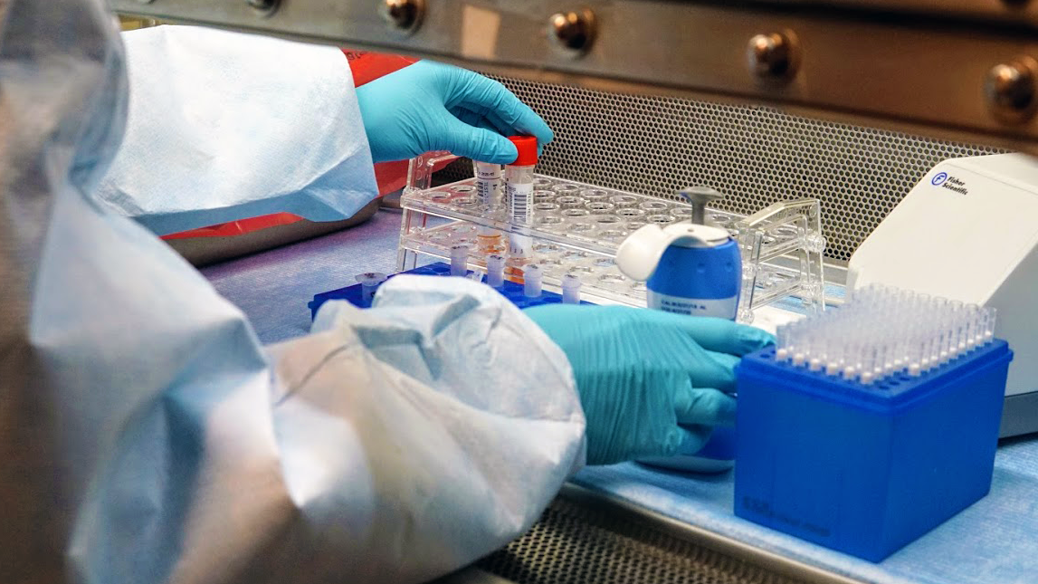 How the U.S. Plans to Speed Up Coronavirus Testing – NBC Bay Area