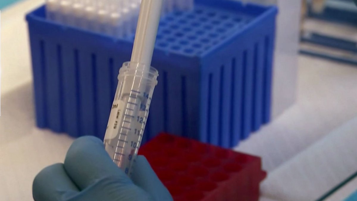 One-on-One With UCSF Dr. George Rutherford – NBC Bay Area