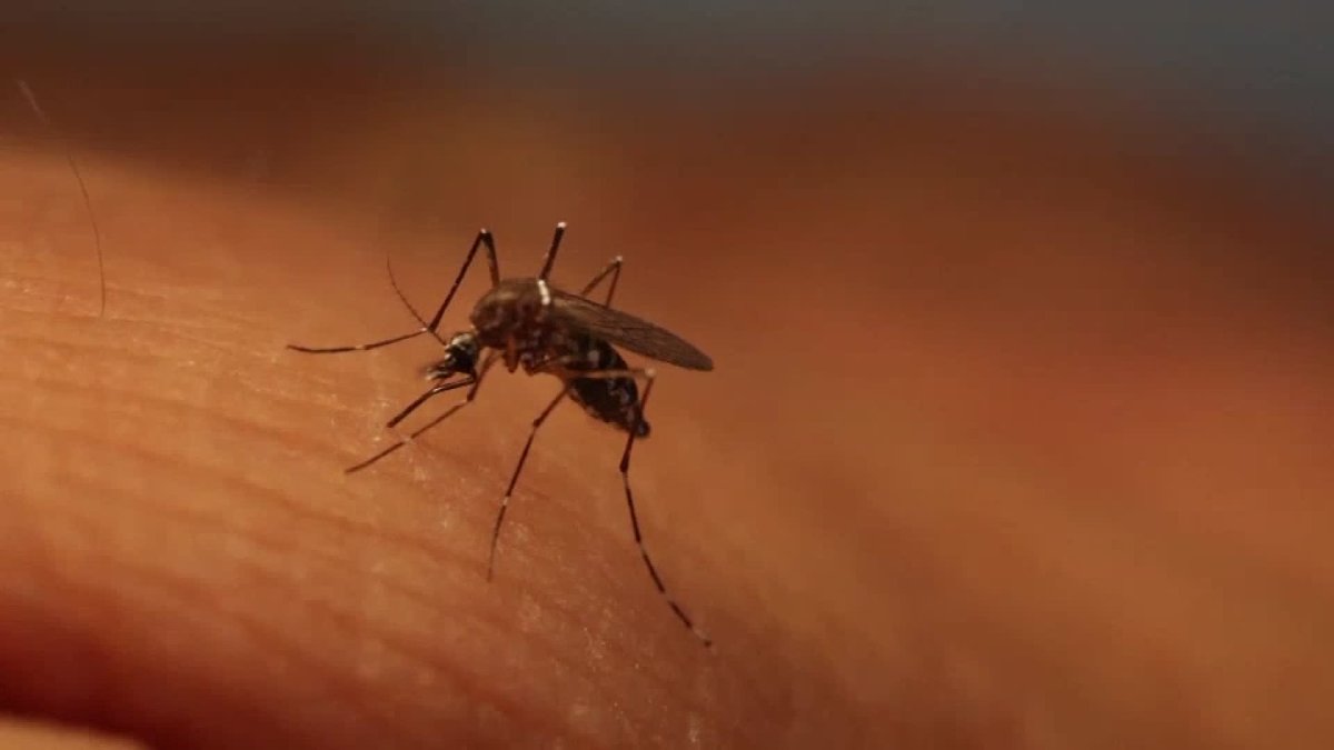Here’s how to treat those itchy mosquito bites – NBC Bay Area