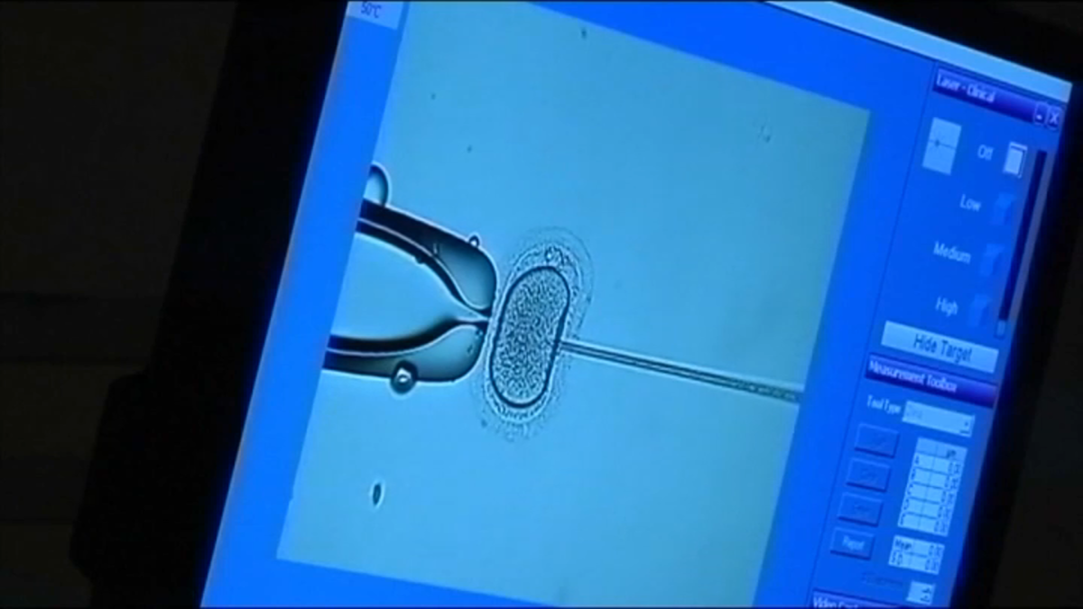 Lawsuit Alleges Doctor Impregnated Bay Area Woman With His Sperm Nbc Bay Area