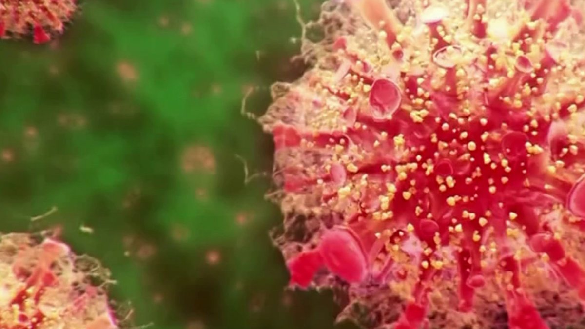 Doctors Warn of Highly-Contagious Delta Variant – NBC Bay Area