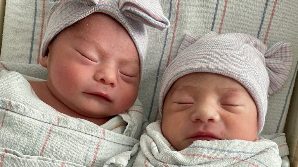California Twins Born in Different Years – NBC Bay Area