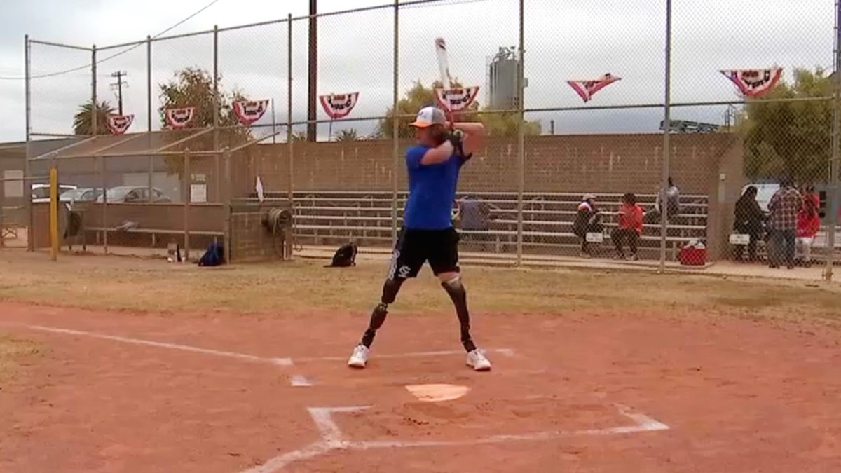 Landis Sims, Baseball Player Without Hands and Feet, Inspires Others ...
