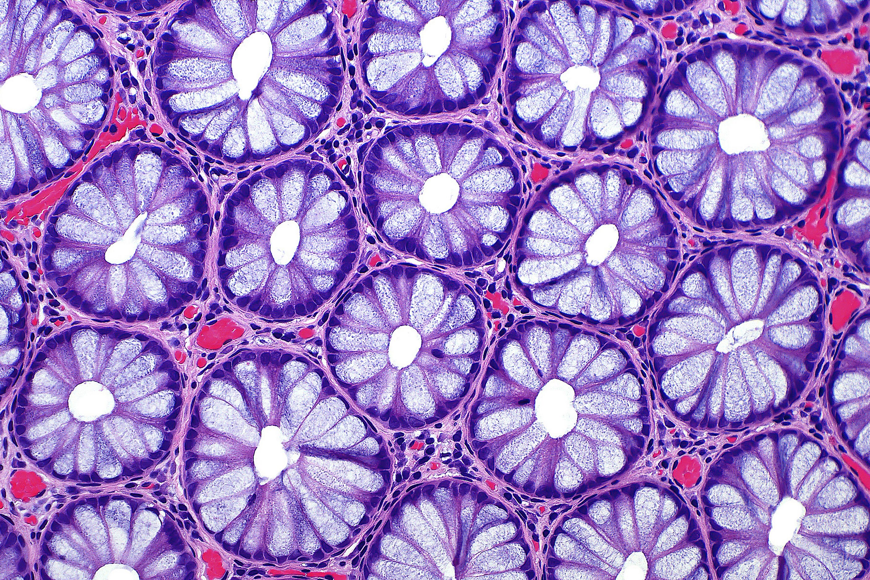 Photos Capture World of Microscopic Wonders – NBC Bay Area