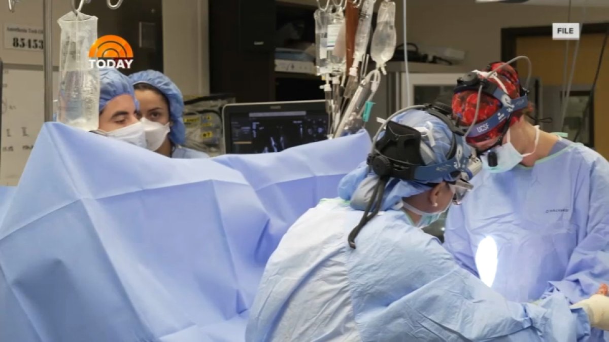 UCSF Boasts First All-Female Team to Perform Heart Transplant – NBC Bay ...