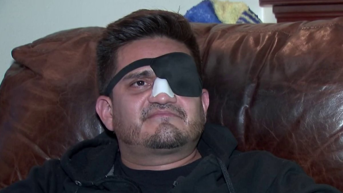 Man speaks out after being robbed, attacked in San Francisco – NBC Bay Area Man speaks out after being robbed, attacked in San Francisco – NBC Bay Area