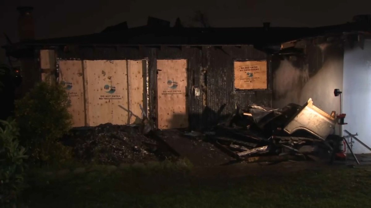 2 injured, displaced in Costra Costa County house fire – NBC Bay Area