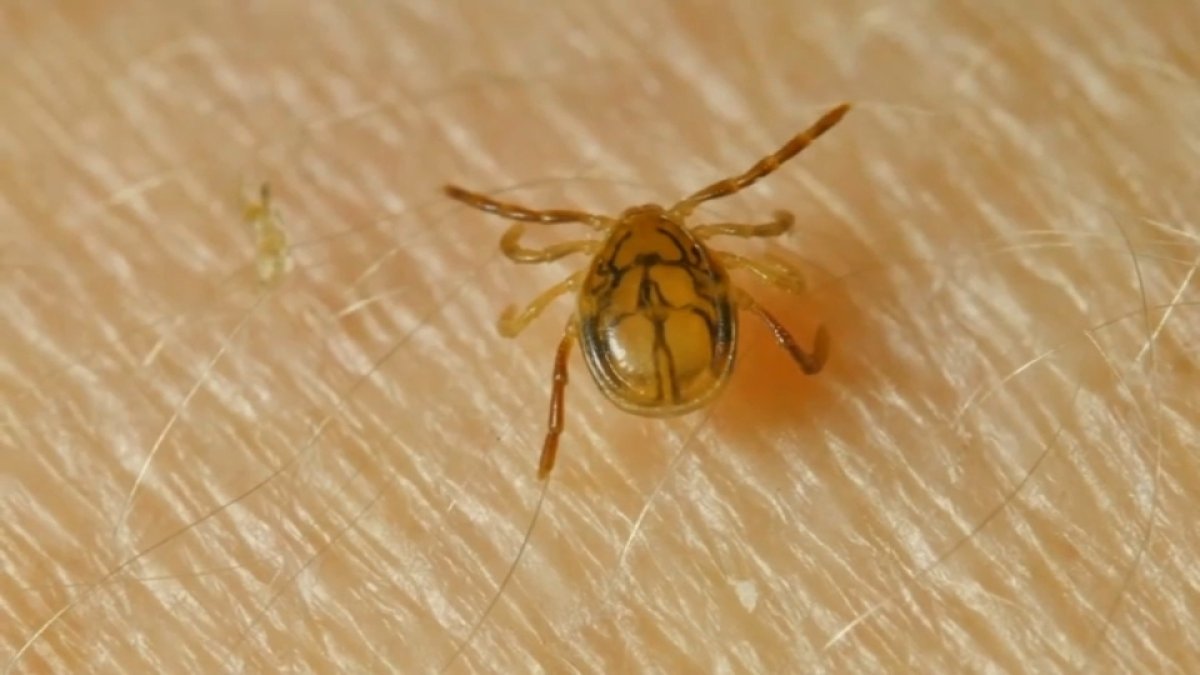 Tick season: Experts warn public of rise in tick sightings in the Bay ...