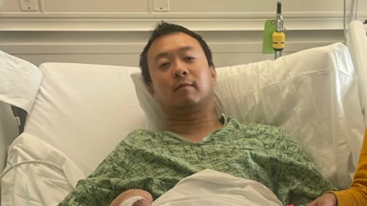 Lake Merritt shooting victim speaks out – NBC Bay Area