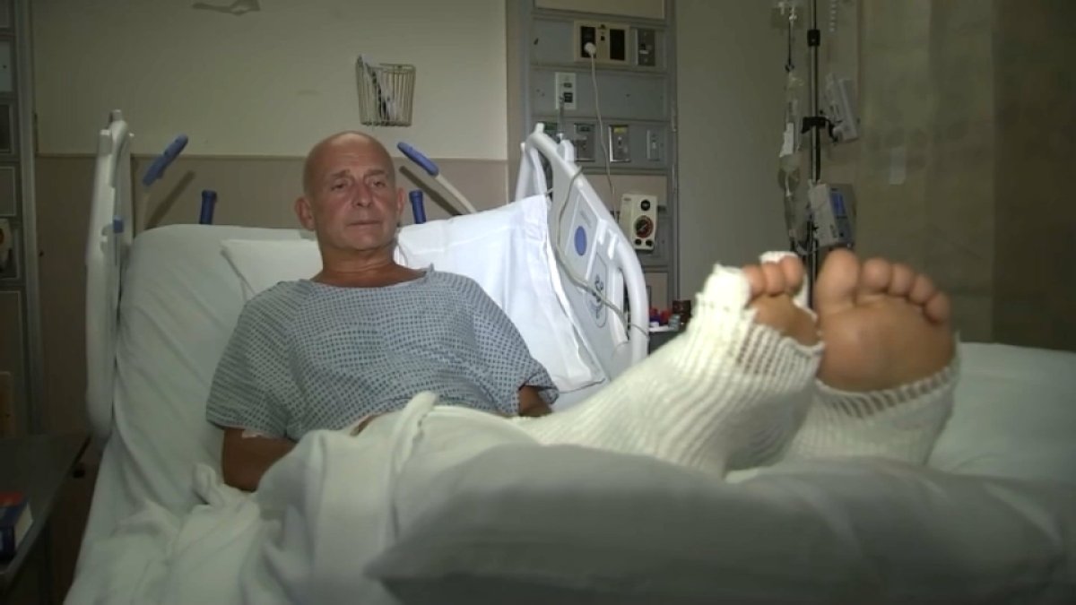 Man recounts serious injury from illegal July Fourth fireworks in San ...