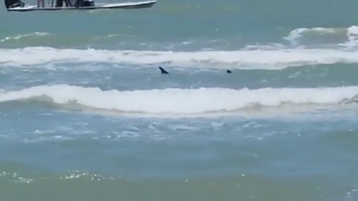 North Texas woman shares story of being attacked by shark – NBC Bay Area