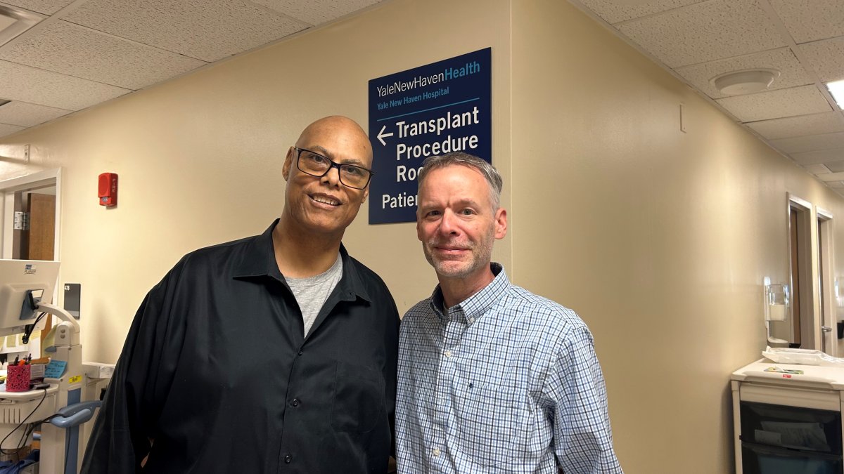 NBC Sports employee donates kidney to coworker – NBC Bay Area