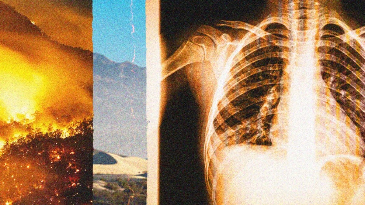 California could face record Valley fever fungal infections – NBC Bay Area