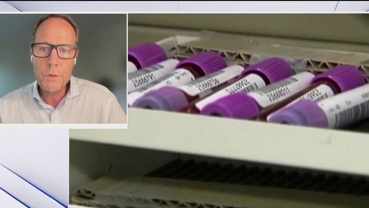 Understanding a new tool used to track how organs age – NBC Bay Area