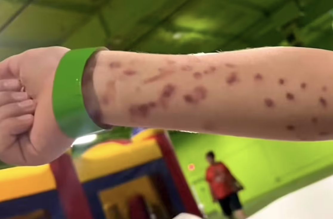 Boy injured when octopus grabbed his arm at Texas aquarium – NBC Bay Area