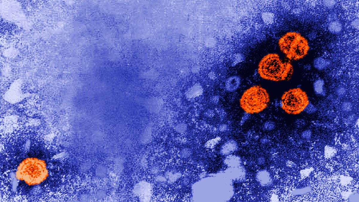 Experimental hepatitis B drug might offer ‘functional cure’ – NBC Bay Area